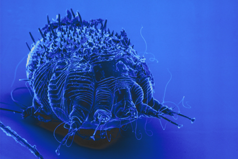 Työpaikalta saatu syyhy on ammattitauti - Hoito vaatii oikeat lääkkeet ...